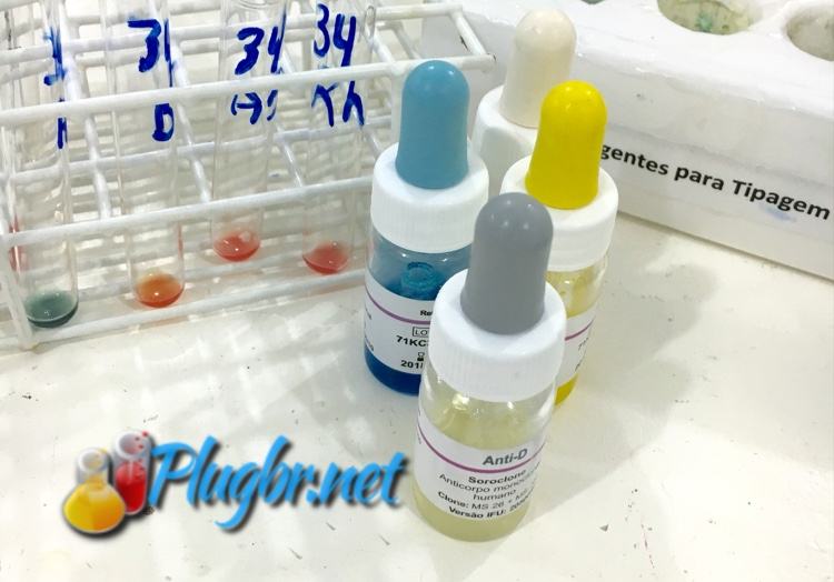 Tipagem Sanguínea - O Exame, Resultado Do Cruzamentos De Sangue Pai Mãe ...