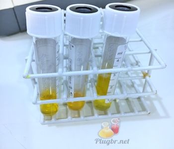 Exame Cloretos, Cloro, Ou Cloremia, Coleta Do Sangue Ou Urina, Jejum E ...