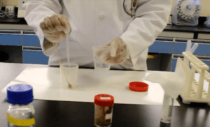 Exame de fezes, pode ou não guardar o material na geladeira e por ...