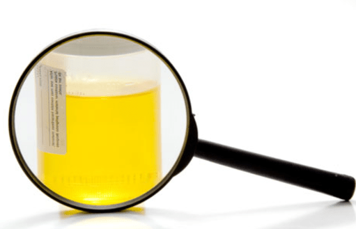 Raras Bactérias No Resultado Do Exame De Urina EAS, Normal Ou Alteração ...