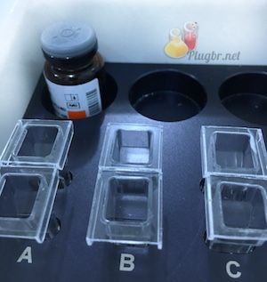 Complemento C4, Para Que Serve Este Exame E Como Coletar O Sangue Para Verificar Níveis | Plugbr.net