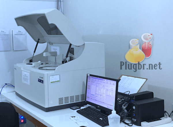 Resultados De Exames Creatinoquinase CK Total E CK MB Alterados Em ...