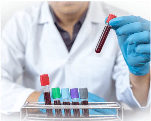 Exame Complemento C3, CC3, Para Que Serve, Coleta E Valores Alterados ...