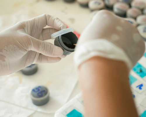 Exame Cloretos, Cloro, Ou Cloremia, Coleta Do Sangue Ou Urina, Jejum E ...